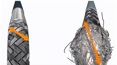 Los 7 motivos principales de fallo en un cable - evita paradas accidentales